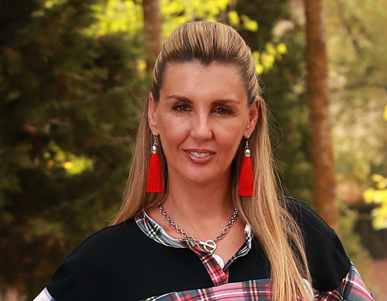 Ana Batista volta a representar a marca Me Wear - Sol e Sombra